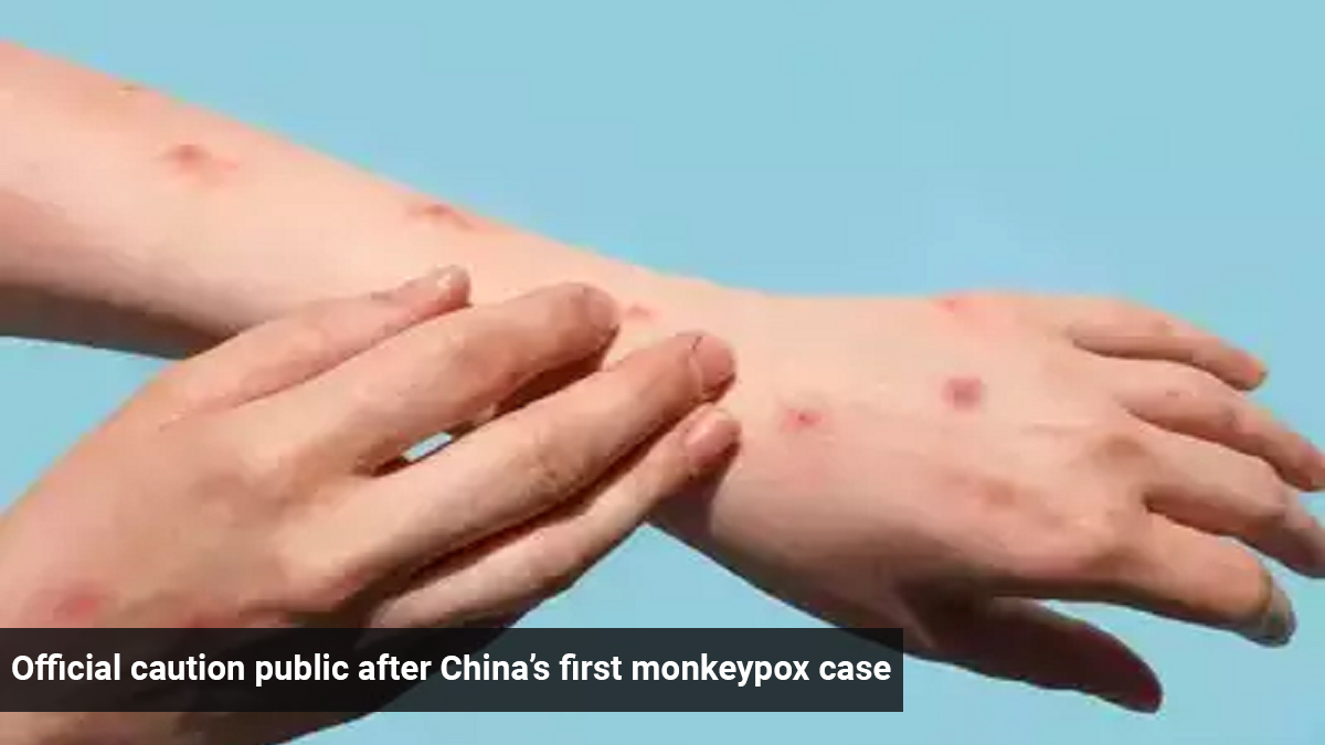 Official Caution Public After China’s First Monkeypox Case